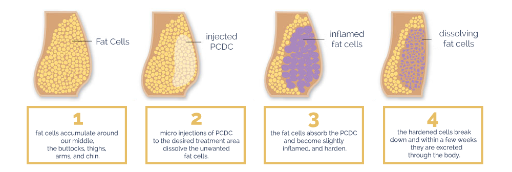 Fat Dissolve - Beyond Body Sculpting